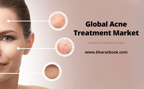 Global Acne Treatment Market :: Research report